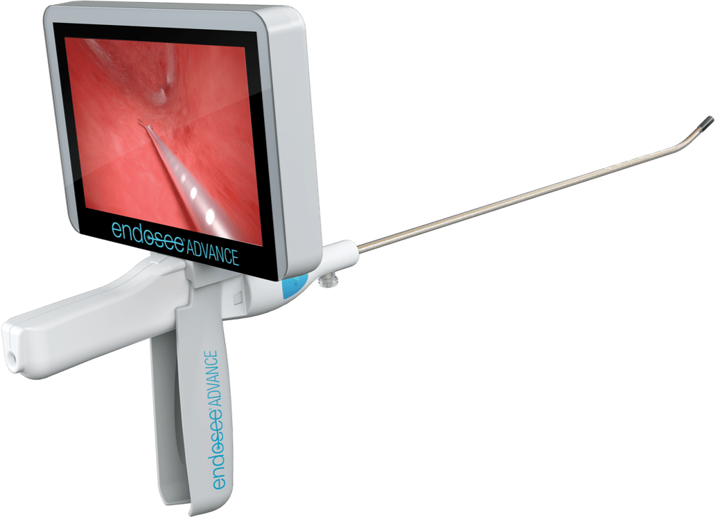 EndoSee Hysteroskop | solann.se